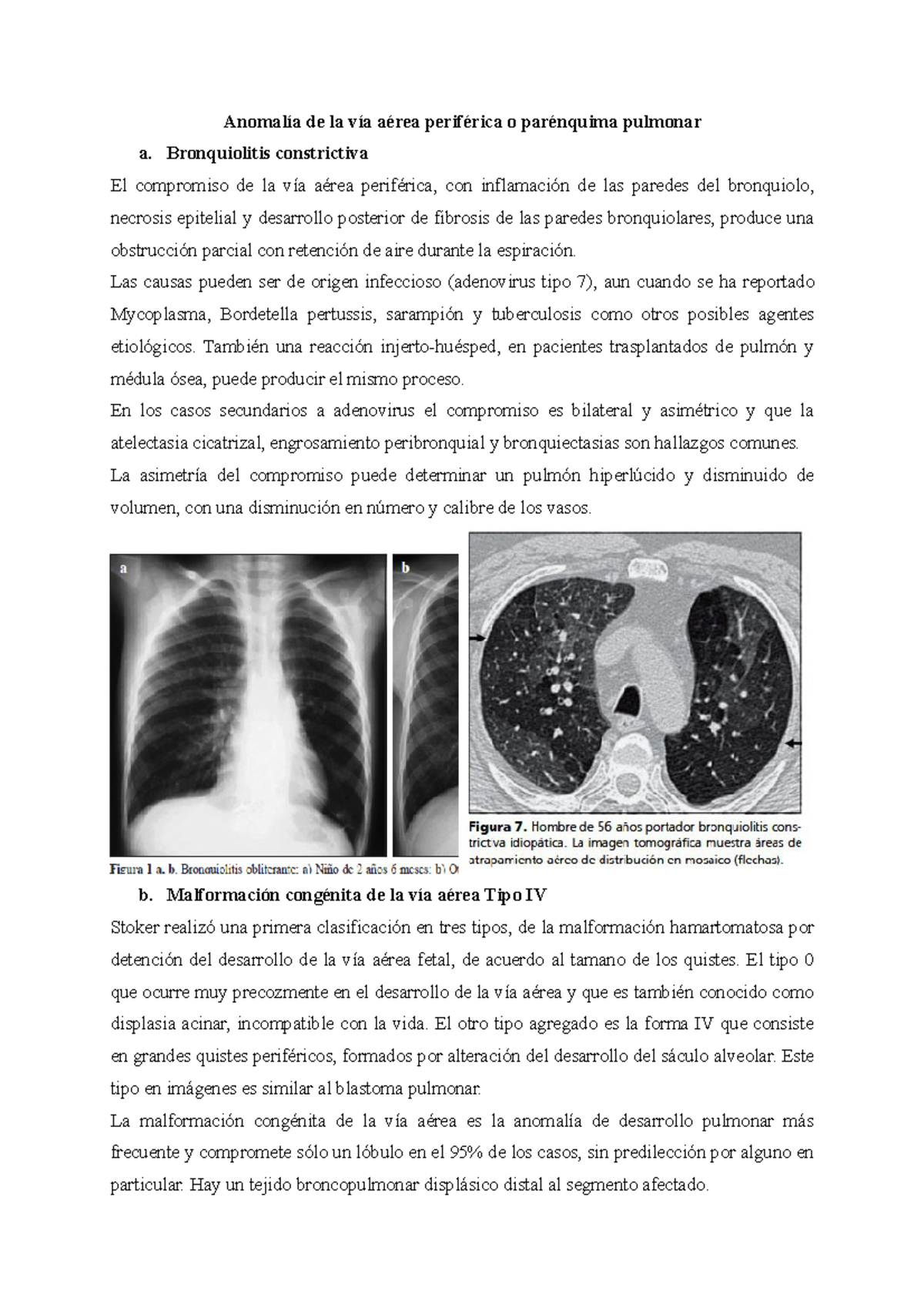3. Tórax: Anomalías de la Vía Aérea y Patologías Pulmonares - Studocu