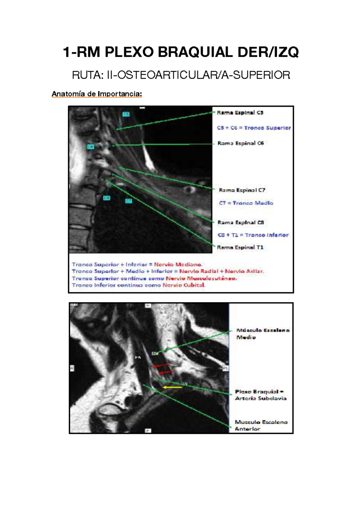 4-RM Plexo Braquial DER IZQ: Anatomía y Protocolo de Imágenes - Studocu