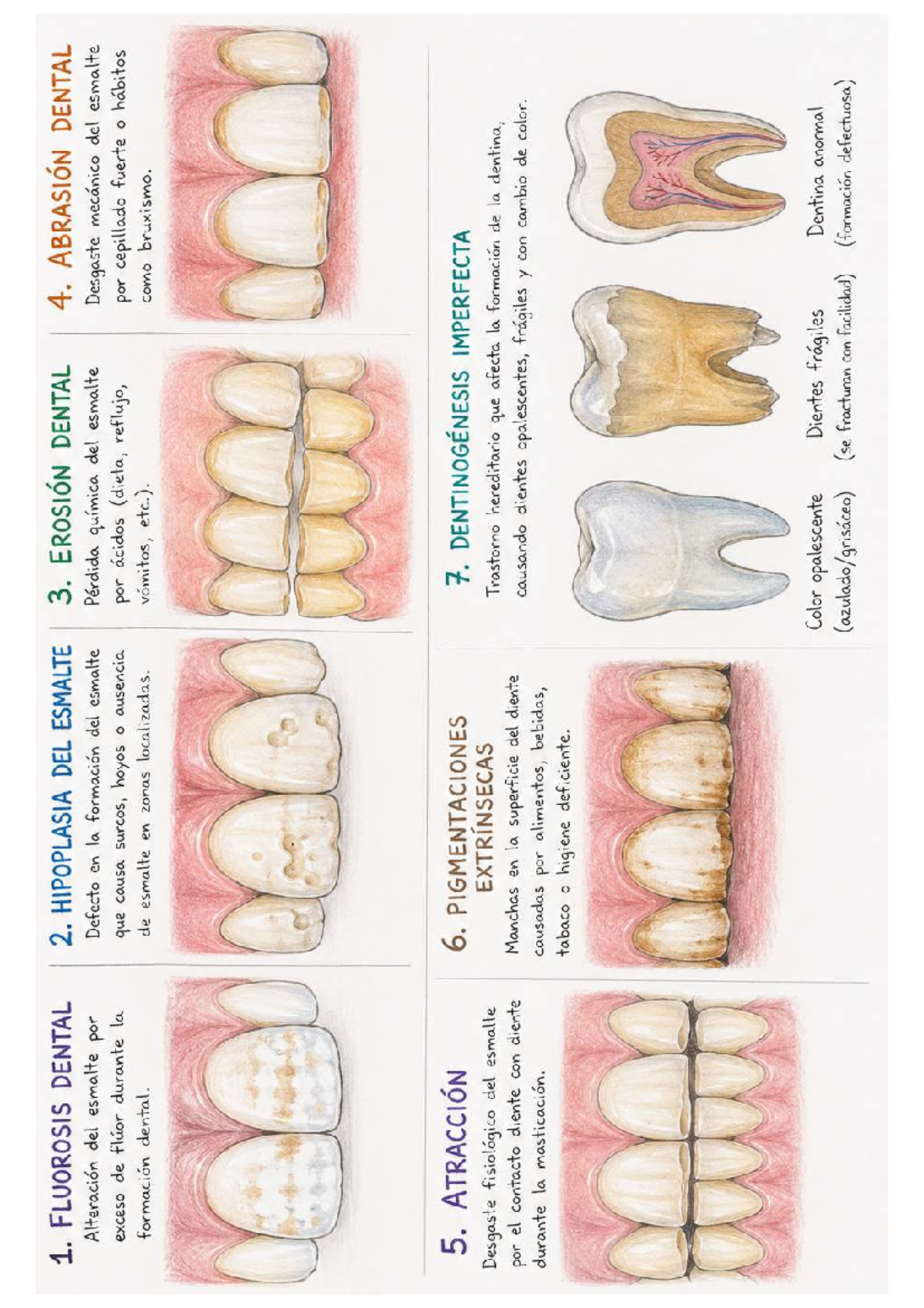 Alteraciones dentales - ﬂdwostmwu—u uoIOWLI0Y ) @dﬁ__.._ﬁsw uod ...