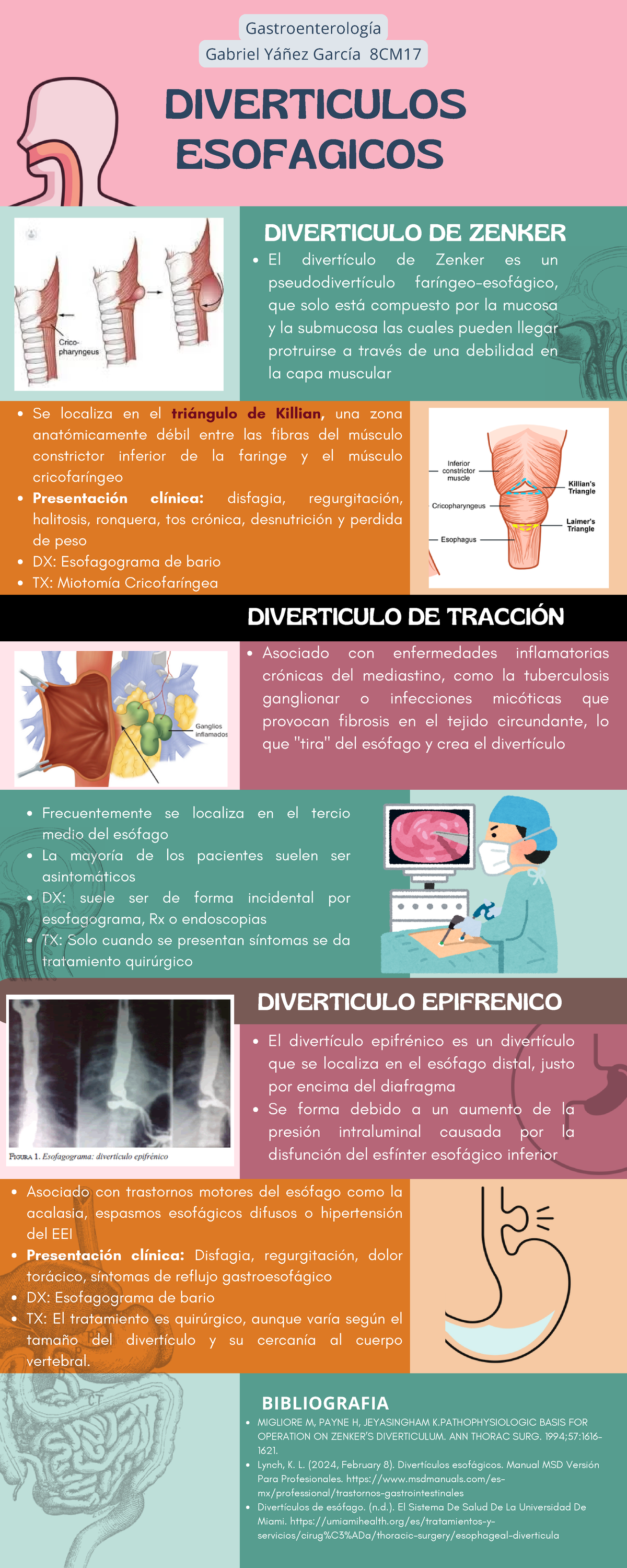 Diverticulos Esofagicos - DIVERTICULOS ESOFAGICOS DIVERTICULO DE ZENKER ...