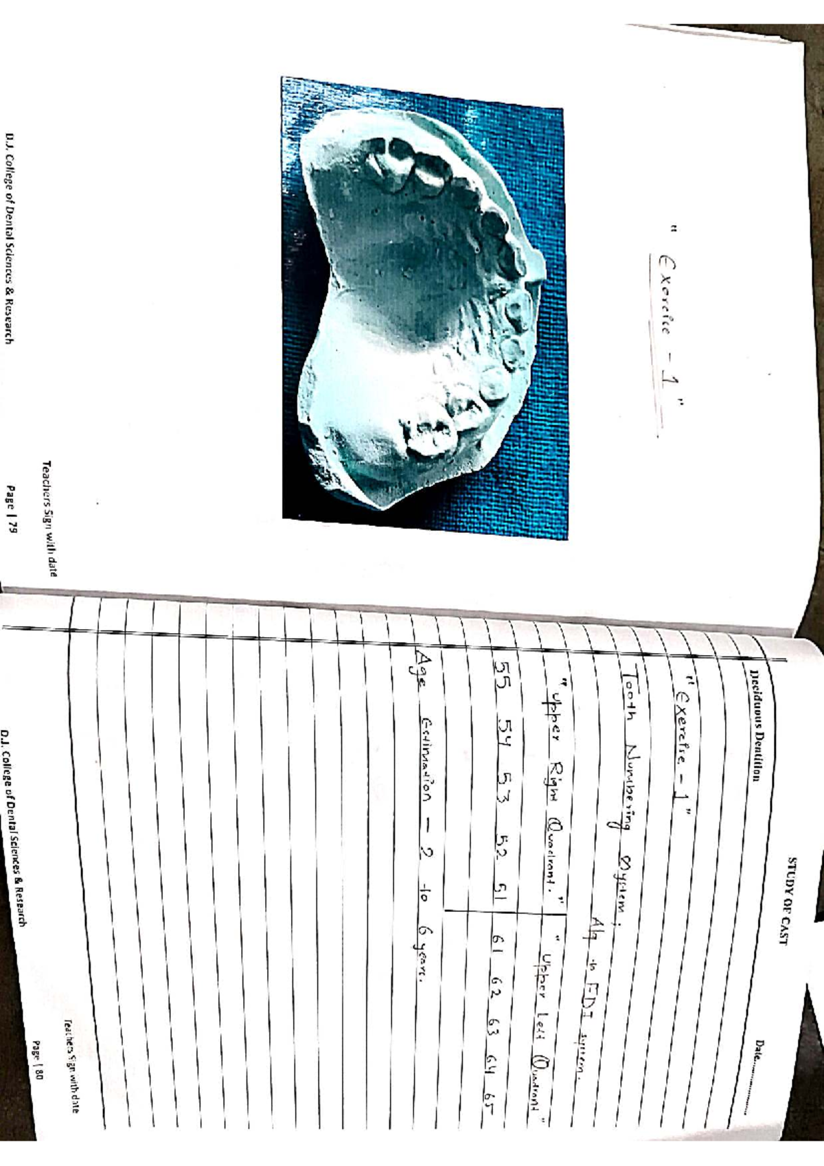 STUDY OF CAST Deciduous & Mixed Dentition Analysis (D.J. College) - Studocu