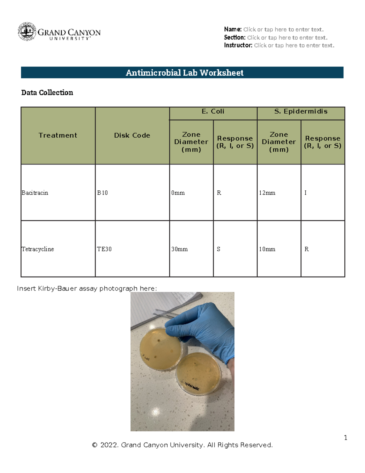 Kirby Bauer Method - Name: Click or tap here to enter text. Section ...