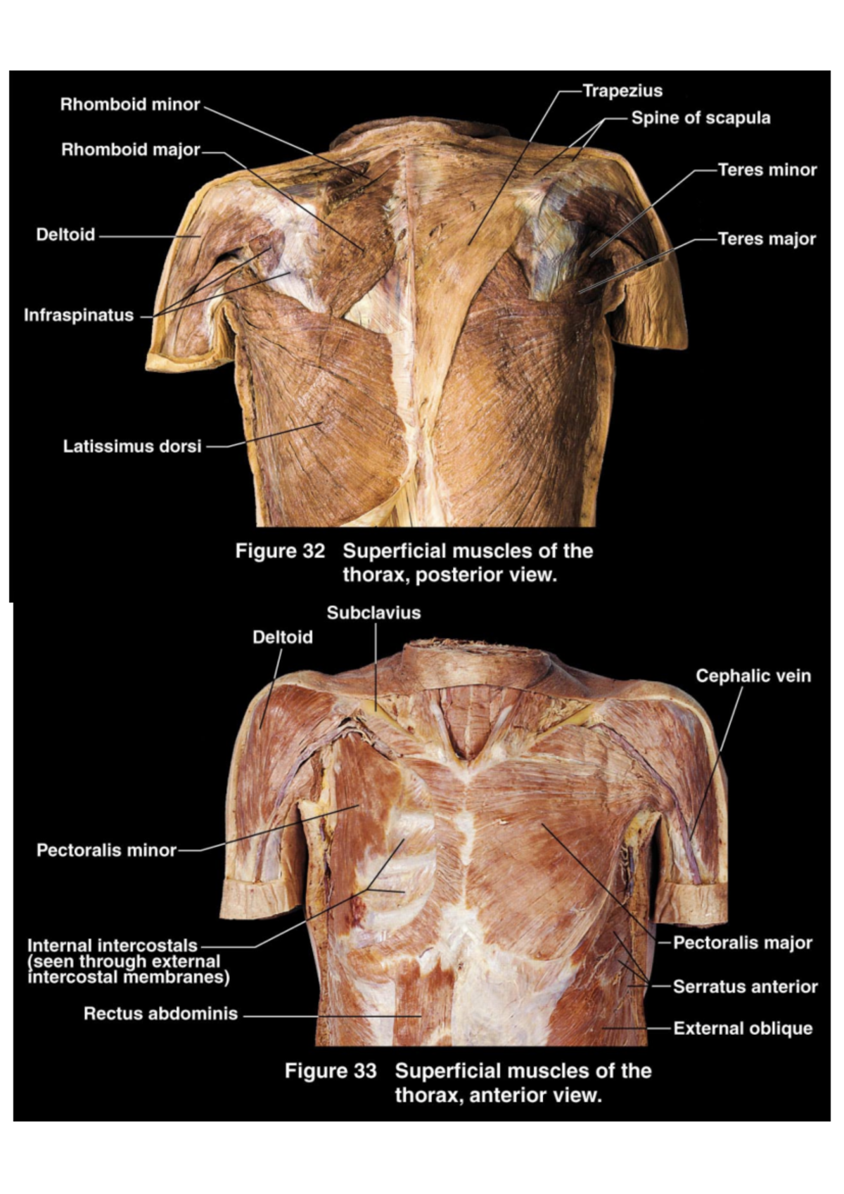 Anatomy of Muscles: Detailed Cadaver Diagrams and Figures - Studocu