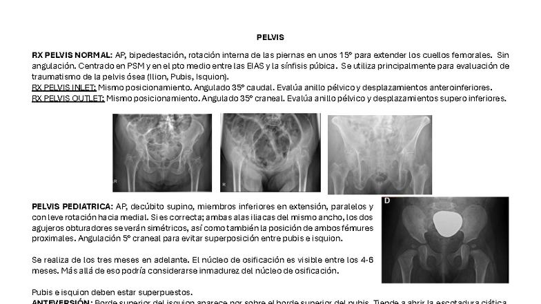 RX PELVIS: Evaluación Normal y Anomalías en Imágenes - Studocu