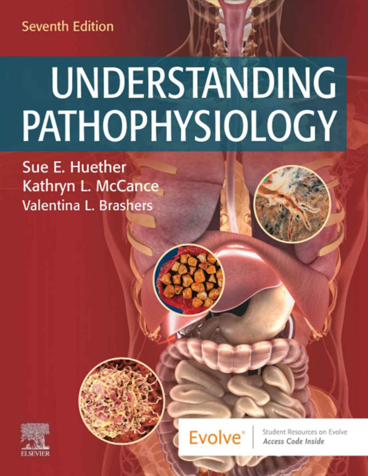 Understanding Pathophysiology (7th Ed) - Key Concepts & Review Notes ...