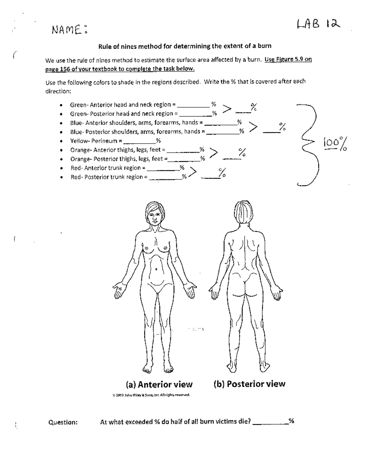 Anatomy Lab 12: Rule of Nines for Burn Assessment - Studocu