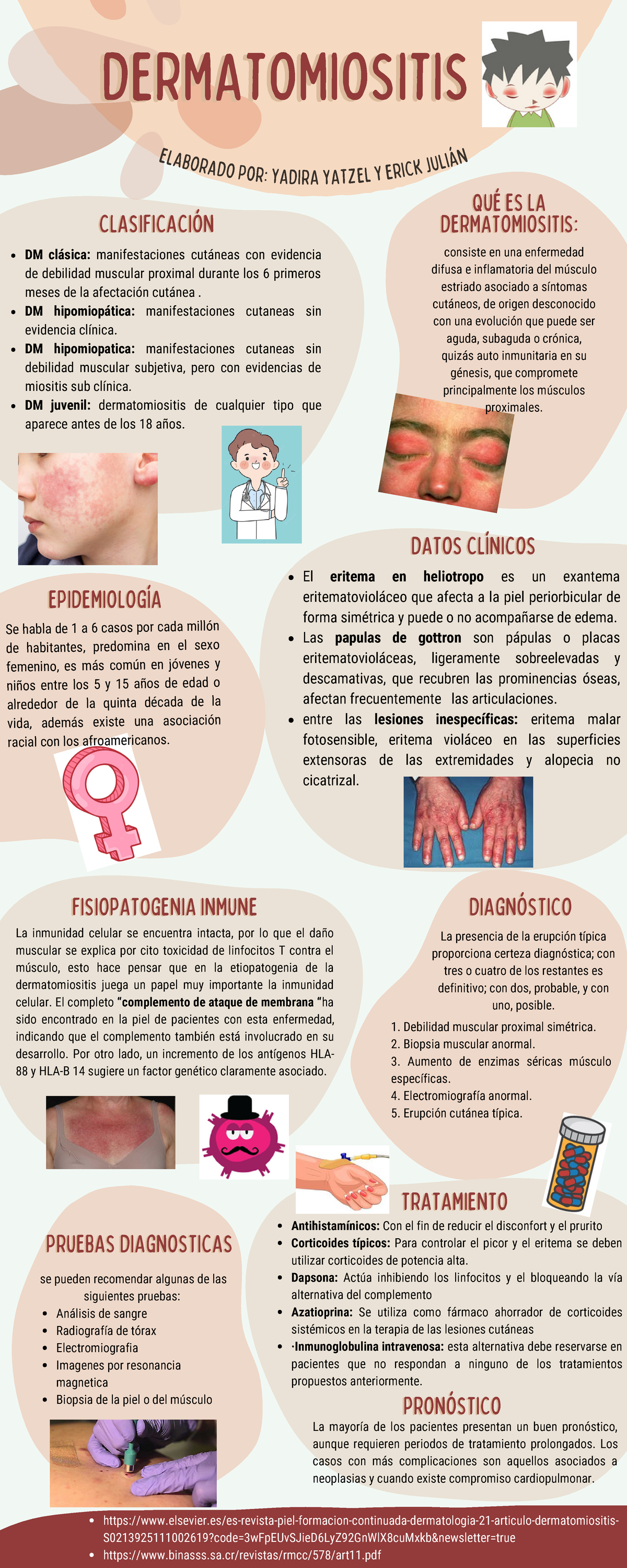 Dermatomiositis - Apuntes bonitos - DERMATOMIOSITISDERMATOMIOSITIS ...