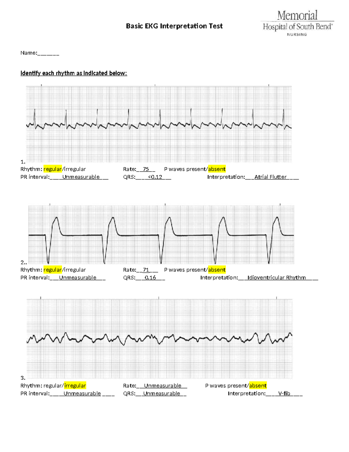 Basic EKG Interpretation Test (2025 AYA) - Studocu