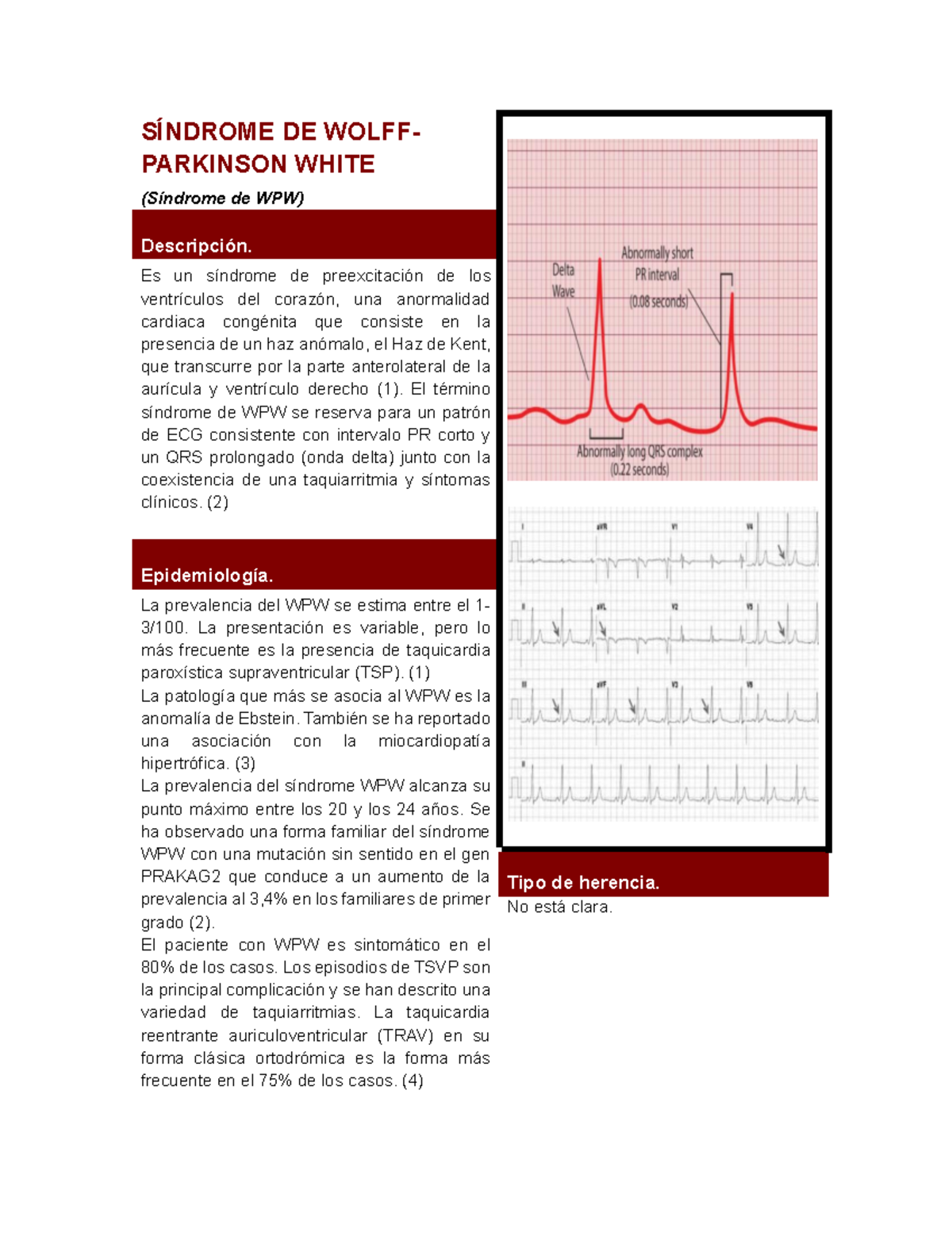 Onda Delta Da Sindrome Wpw Overview Of Wolff Parkinson White Syndrome