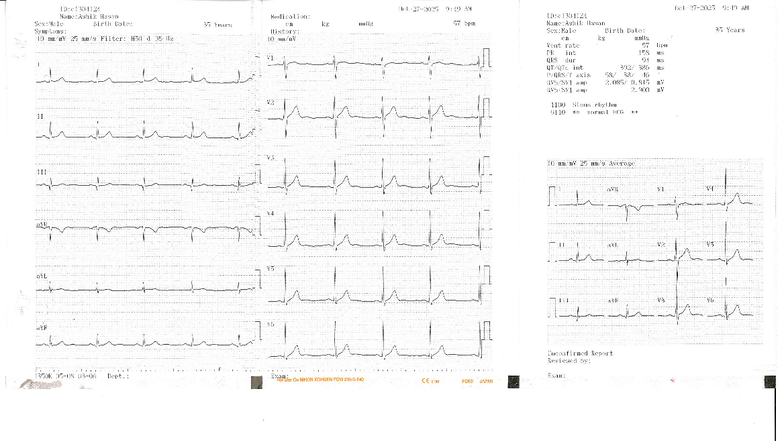 ECG Report - ID:c1304124 for Medical Examination - Studocu