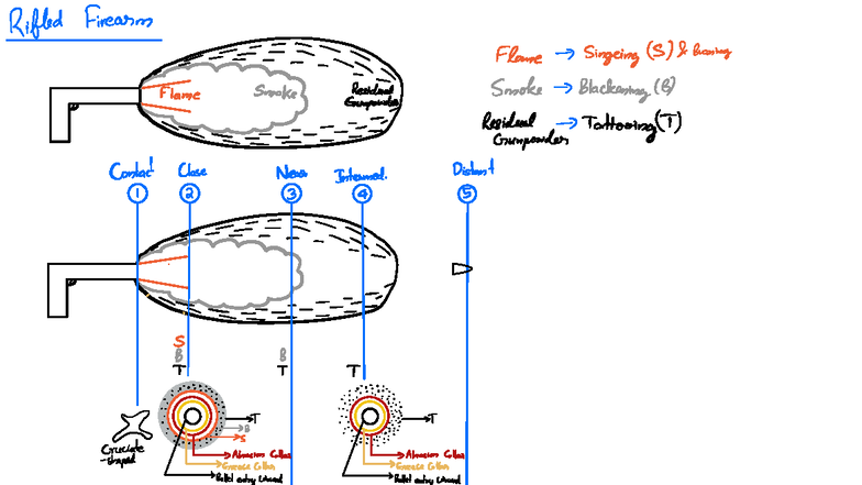 Forensic ballistics entry wound 2 - Forensic medicine and Toxicology ...