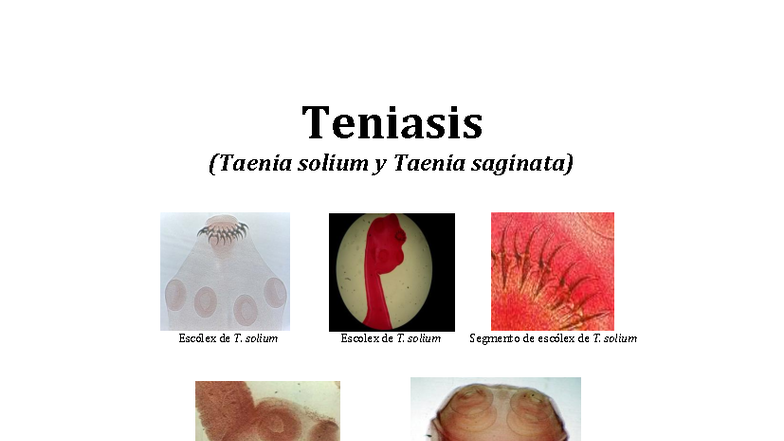 Teniasis Revisado - Estudiar - Teniasis (Taenia solium y Taenia ...