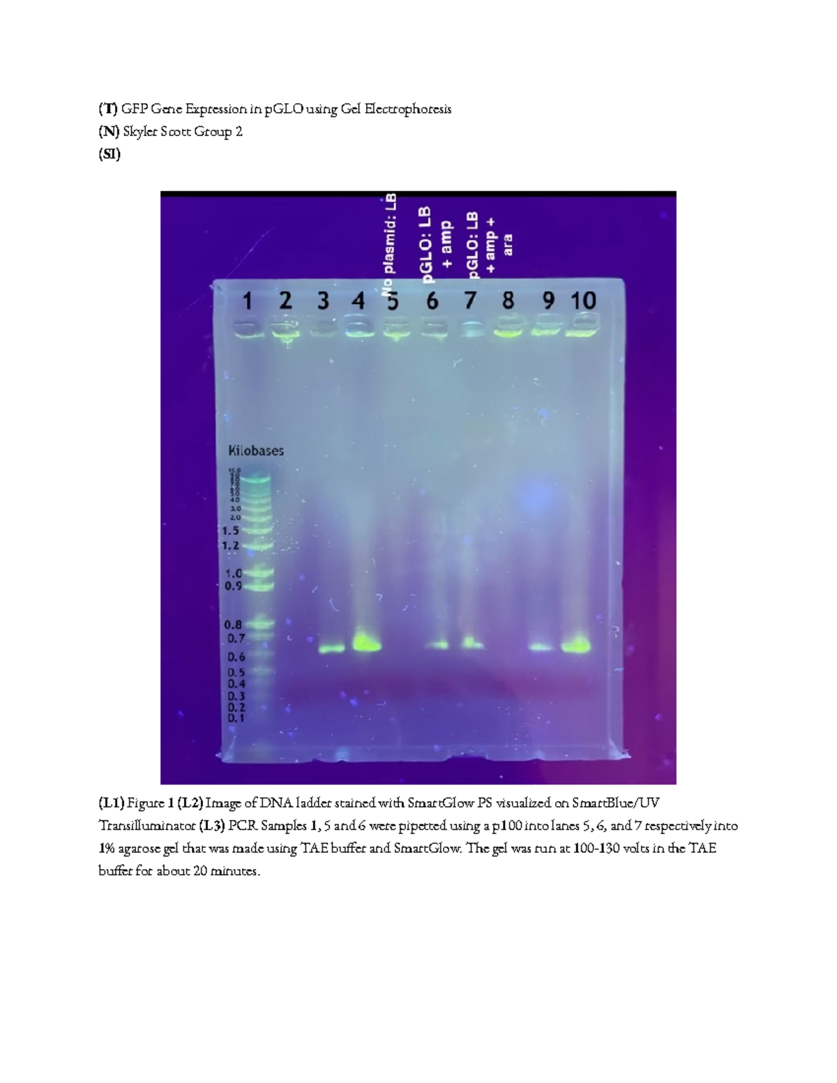 BIOL 113 Lab 10 Report - (T) GFP Gene Expression in pGLO using Gel ...