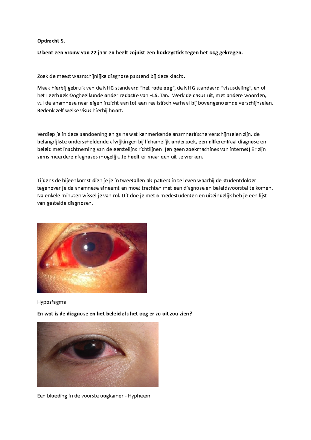 Casus 5: Diagnose en Beleid na Oogtrauma - Oogheelkunde 101 - Studeersnel