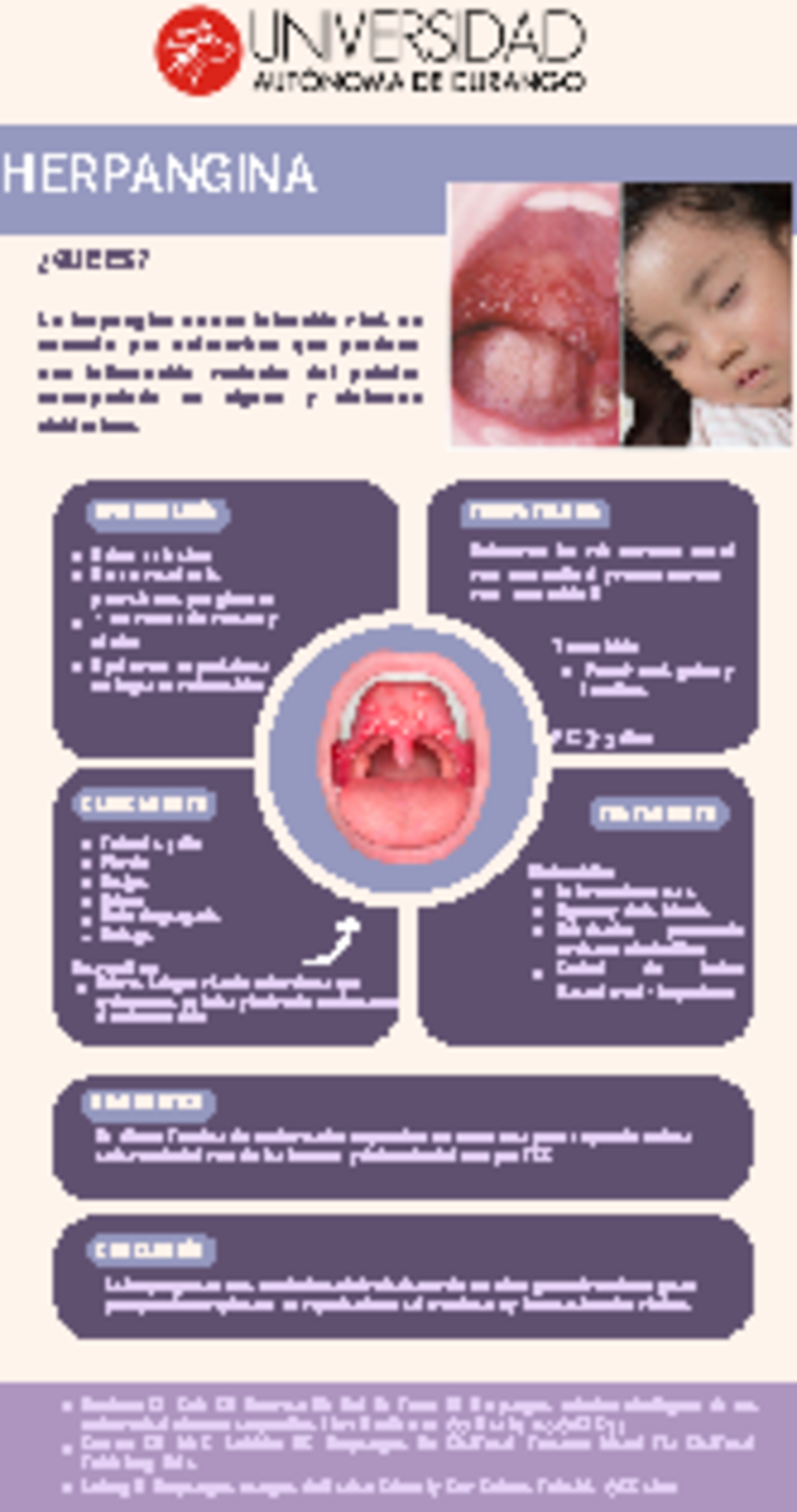 Herpangina - HERPANGINA ¿QUE ES? La herpangina es una infección viral ...