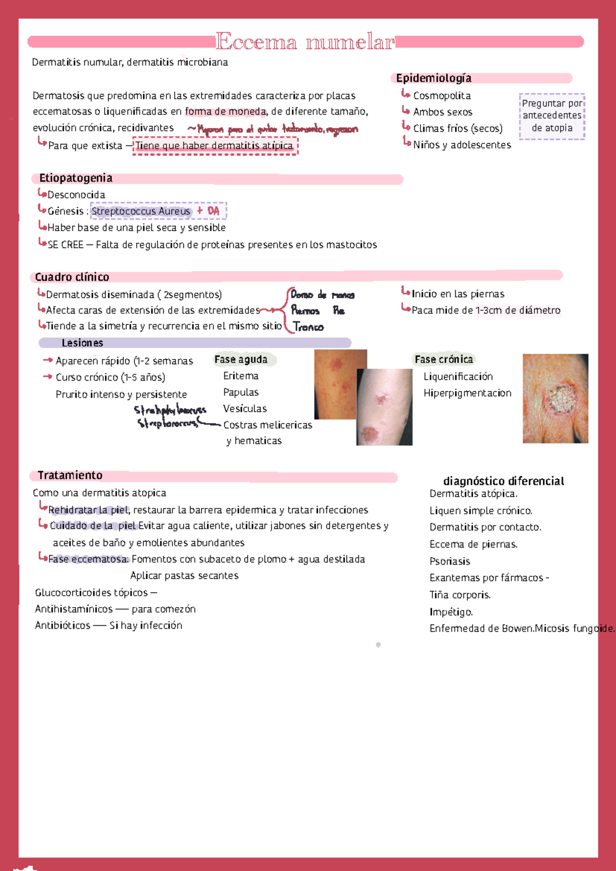 Eccema Numular: Epidemiología y Tratamiento - Dermatosis Reaccional ...