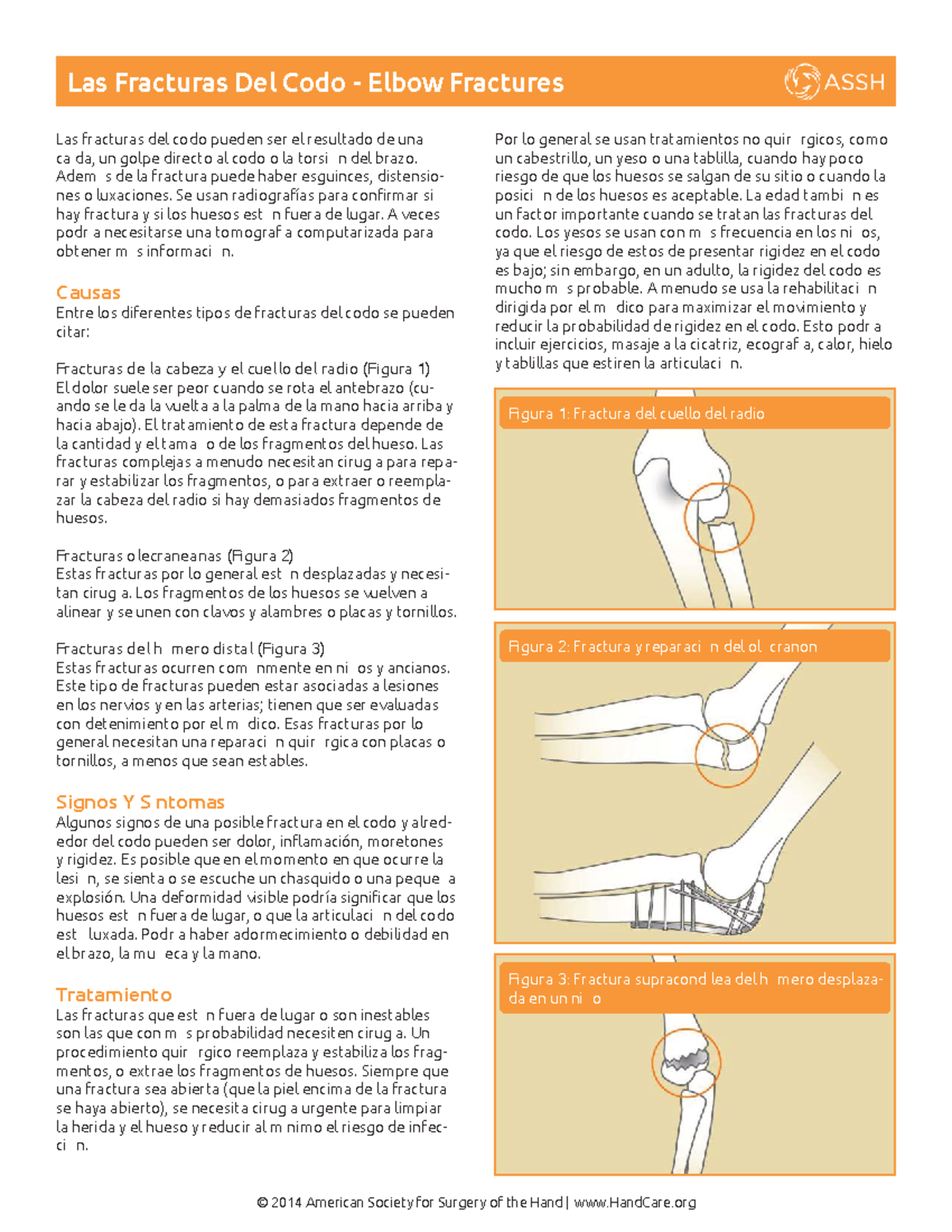 Fracturas del Codo: Causas, Tratamientos y Rehabilitación - Elbow ...