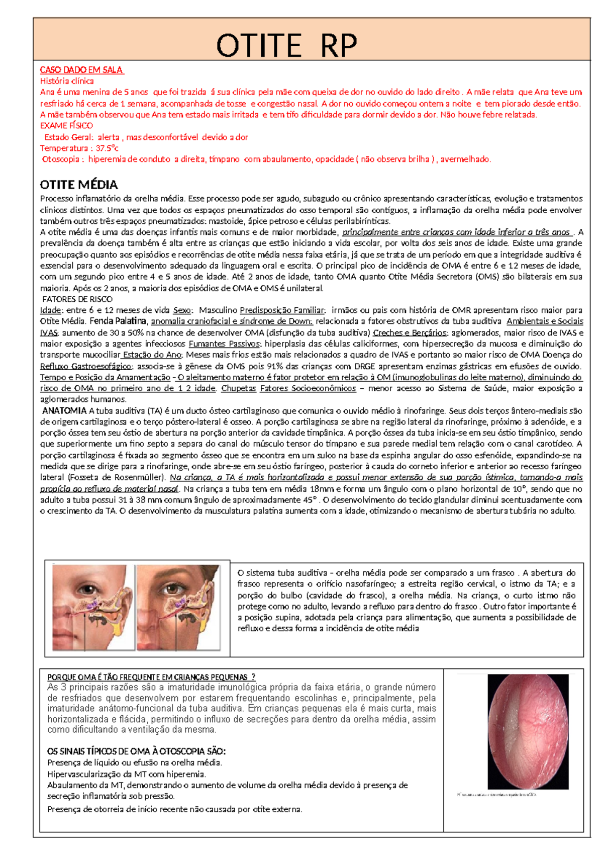 Resumo da Otite Média Aguda em Crianças - RP - Studocu