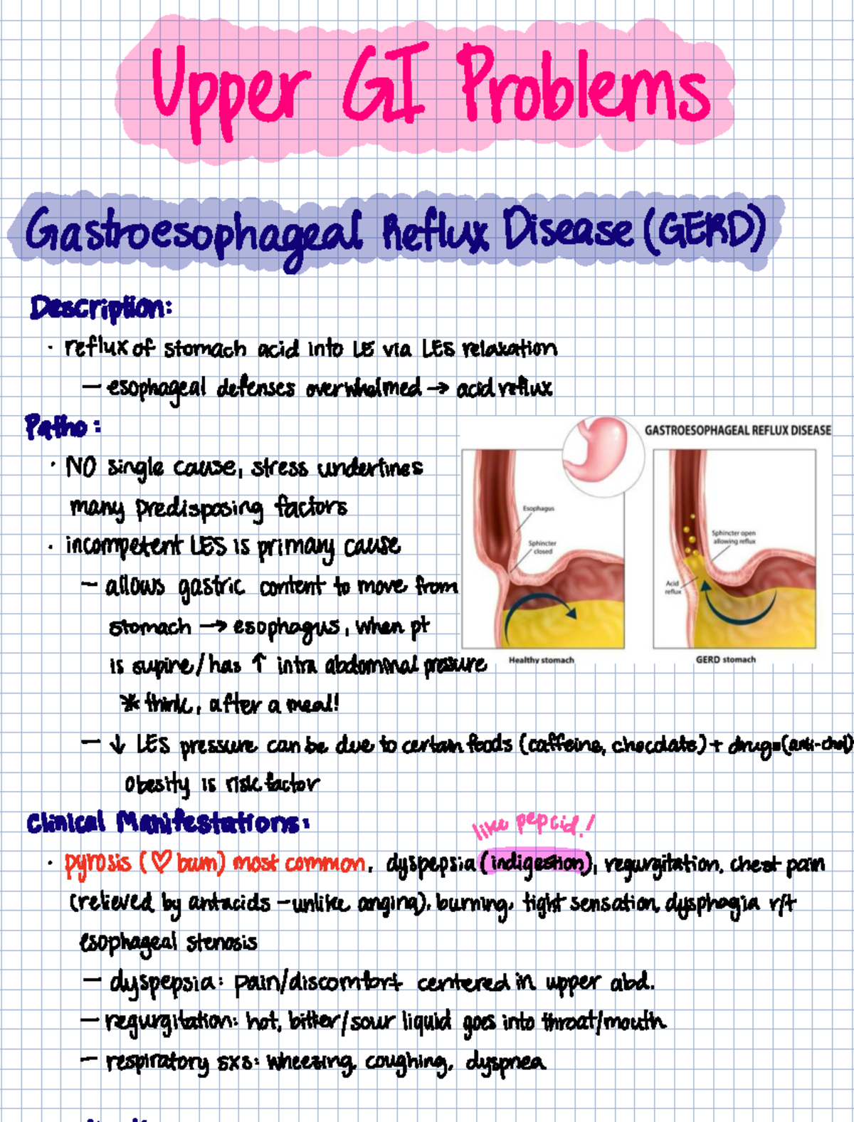 Upper GI Disorders: GERD, Hiatal Hernia, and Gastritis Overview (NUR ...
