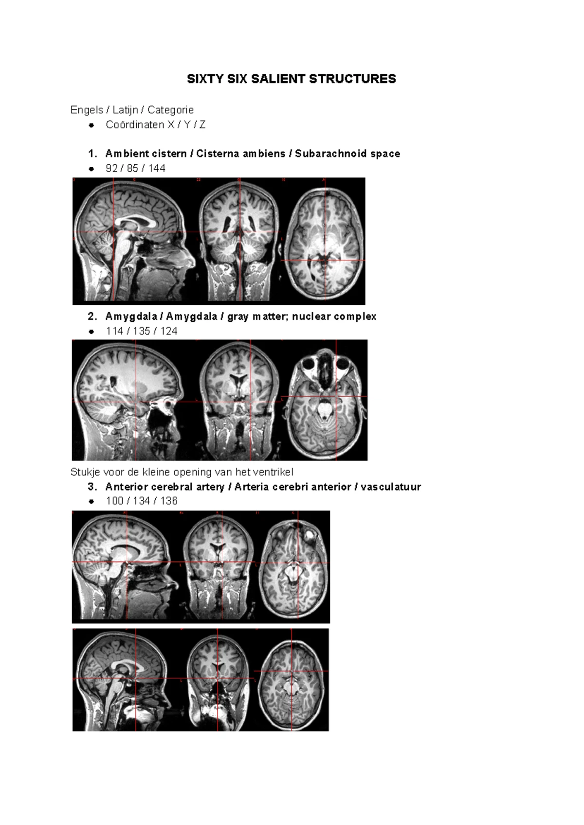 Meningen - 05 - anatomie - Neuroanatomie 05 – meninges Meninges ...
