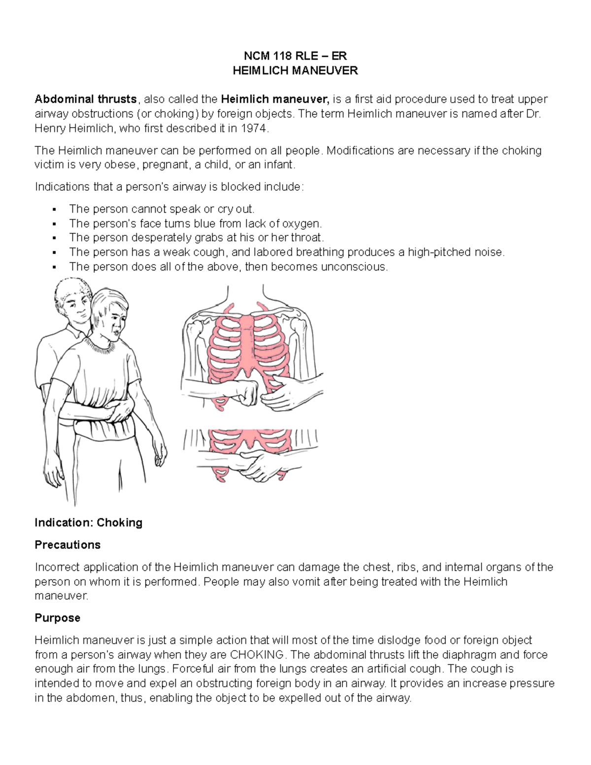 Heimlich Maneuver - The term Heimlich maneuver is named after Dr. Henry ...
