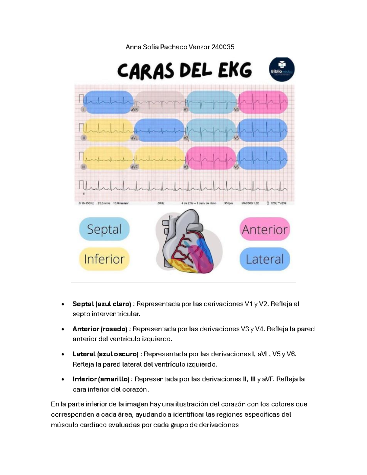 Caras ECG - Para entender mejor ECG - Anna Sofía Pacheco Venzor 240035 ...