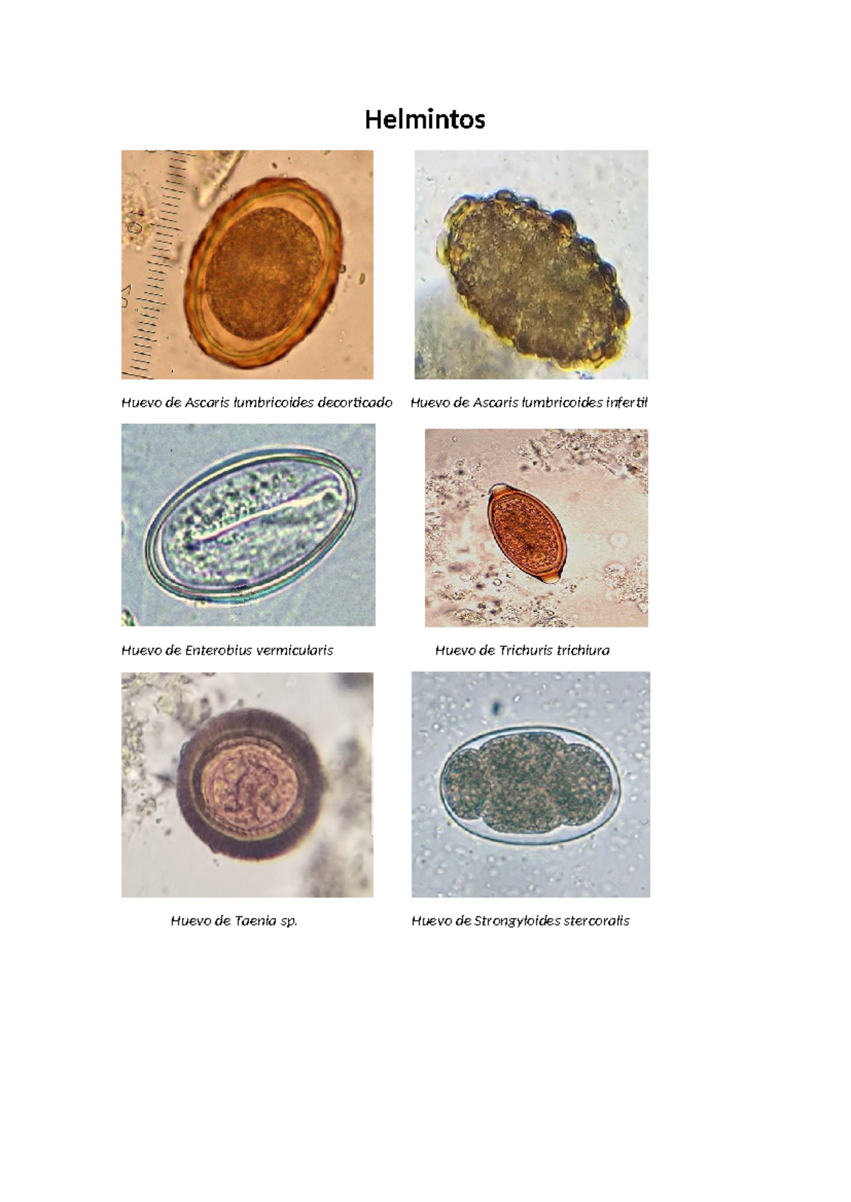 Helmintos - Helmintos Huevo de Ascaris lumbricoides decorticado Huevo ...