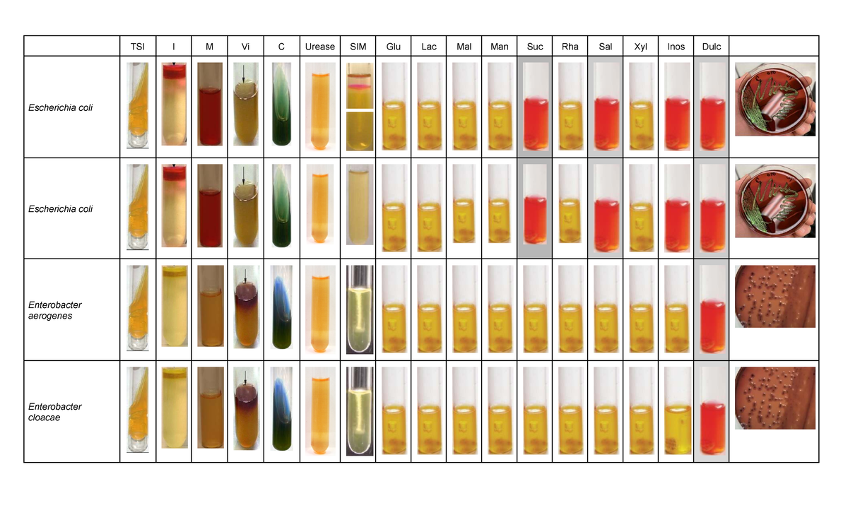 TSI and IMViC Reactions of Enteric Bacteria: 20 Pics (260212) - Studocu