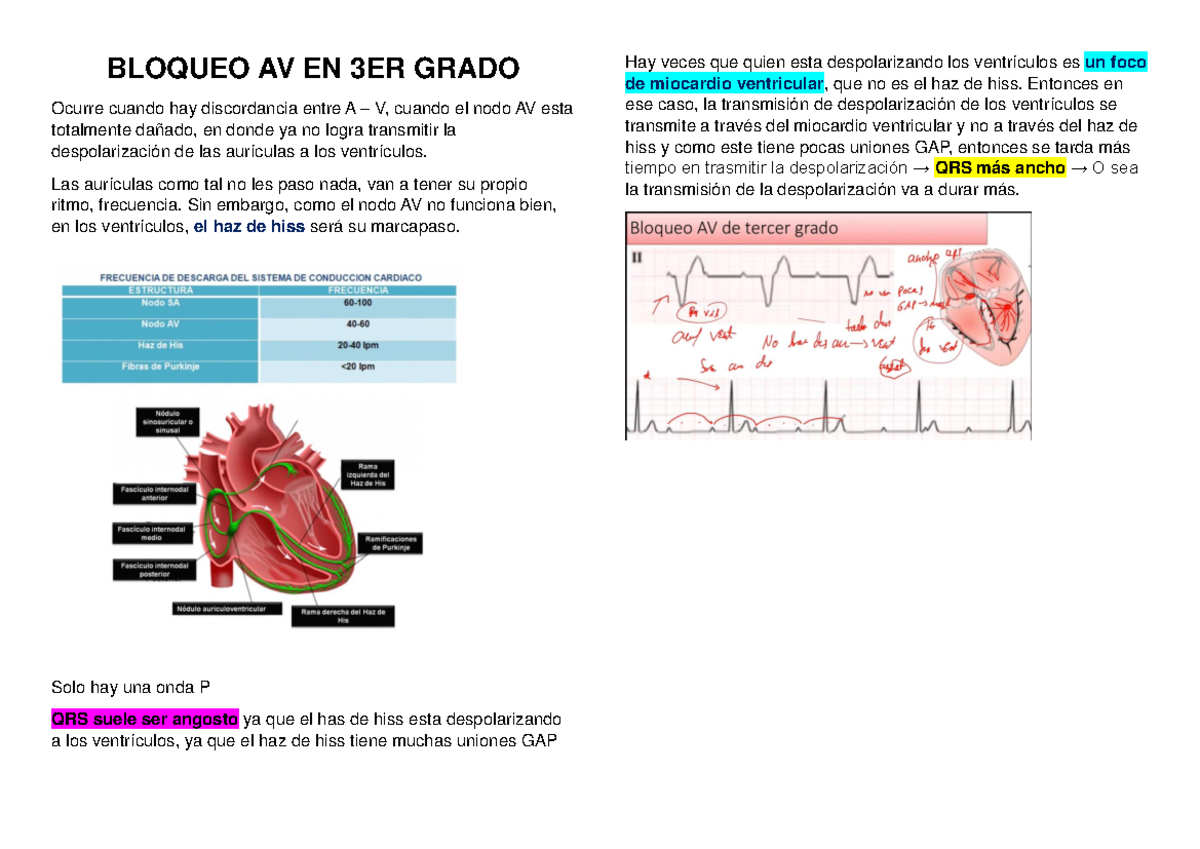 bloqueo av 3er grado - BLOQUEO AV EN 3ER GRADO Ocurre cuando hay discordancia entre A – V ...