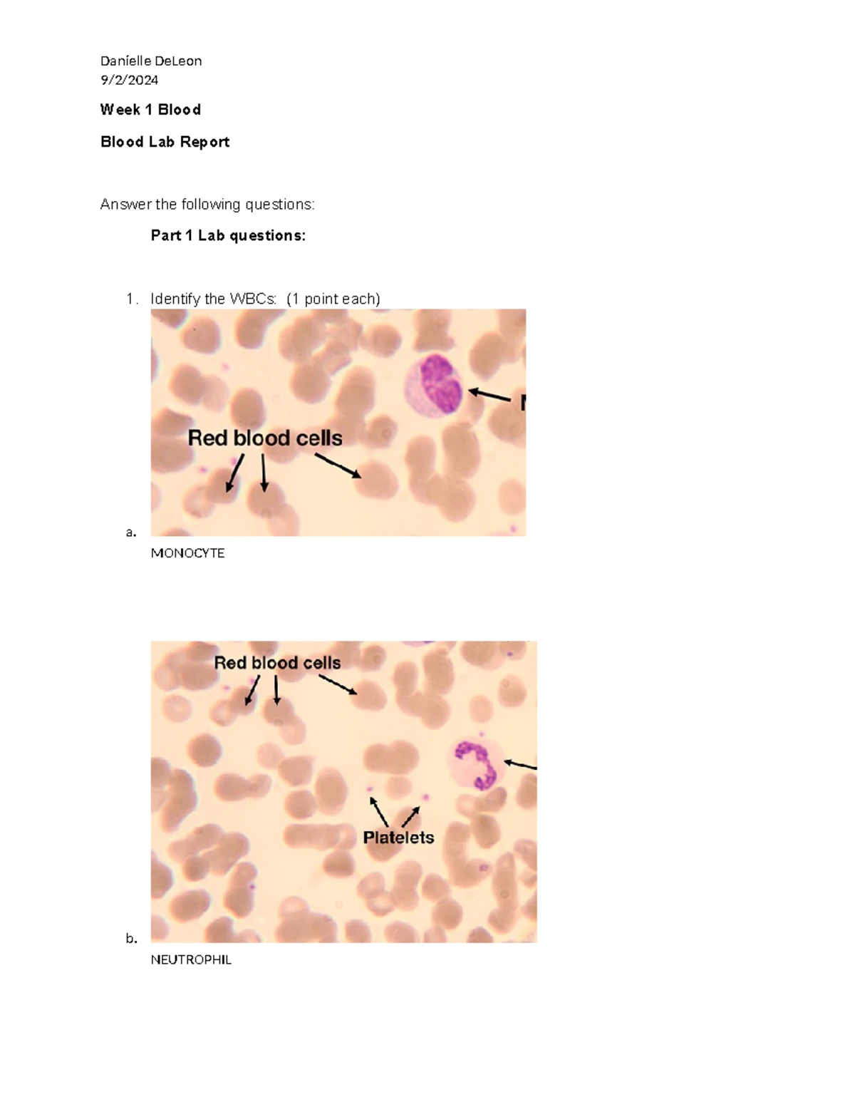 BIOS255 Week 3 Lab Report: Cardiovascular System & Blood Vessels - Studocu