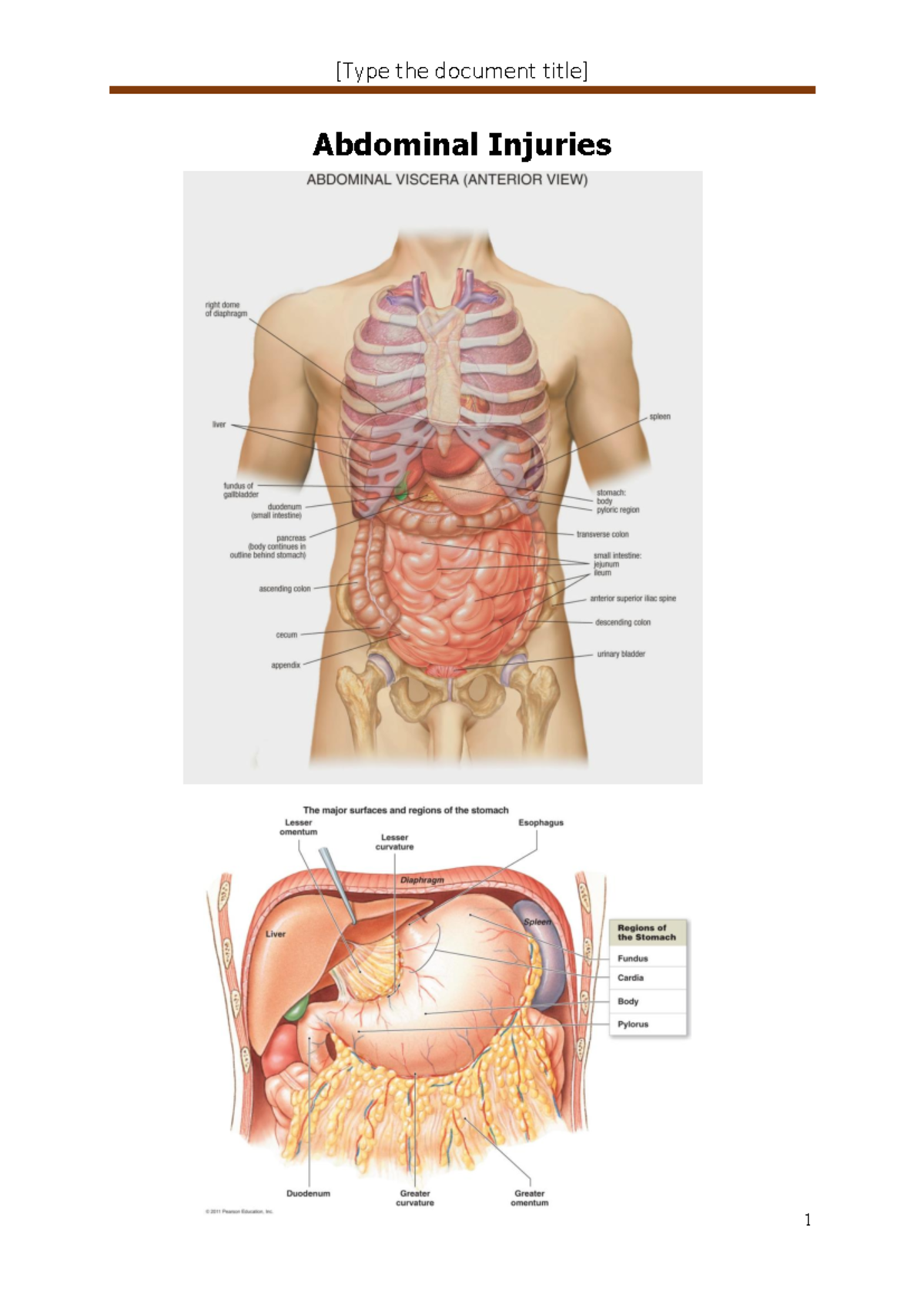 Abdominal Injuries 3 - Best notes - Abdominal Injuries ⁕ Possible ...