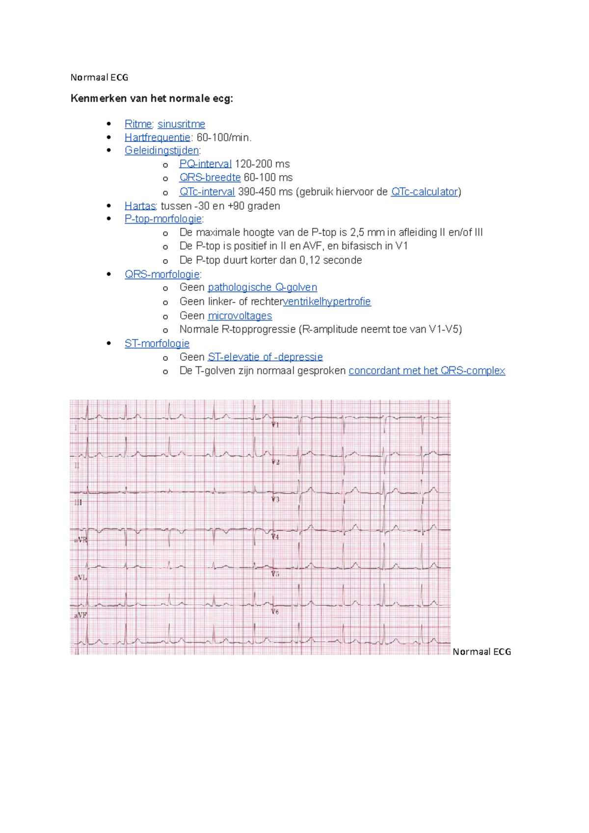 Normaal ECG - Kenmerken, AV-blokken en Voorbeelden Uitleg - Studeersnel