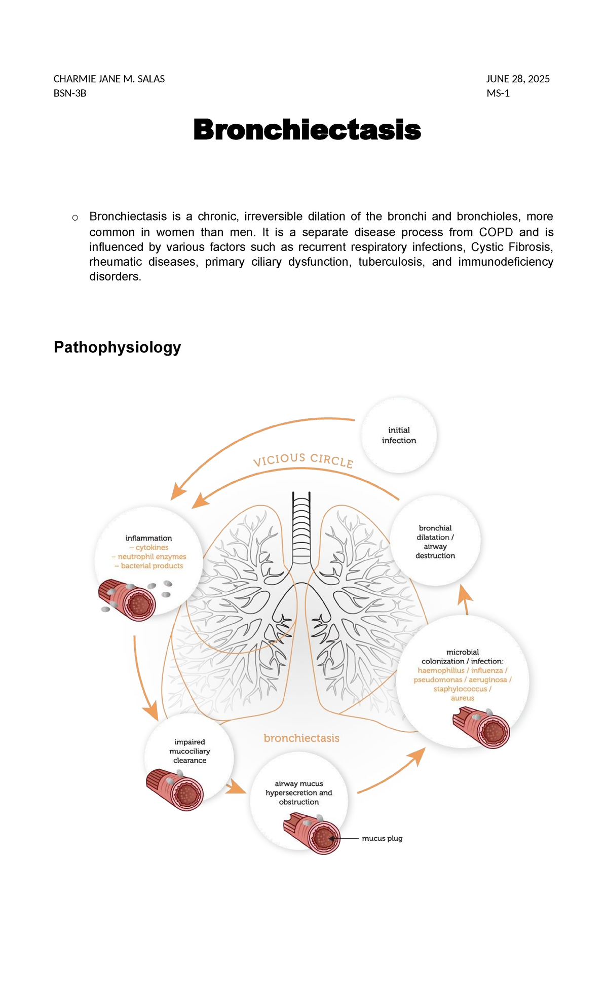Bronchiectasis Management: Transes Final Exam Notes - Studocu