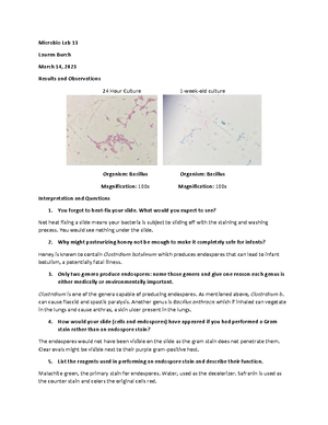 Lab Report 1 Use of the Microscope - MicroBio Lab 1 Report Name: Lauren ...