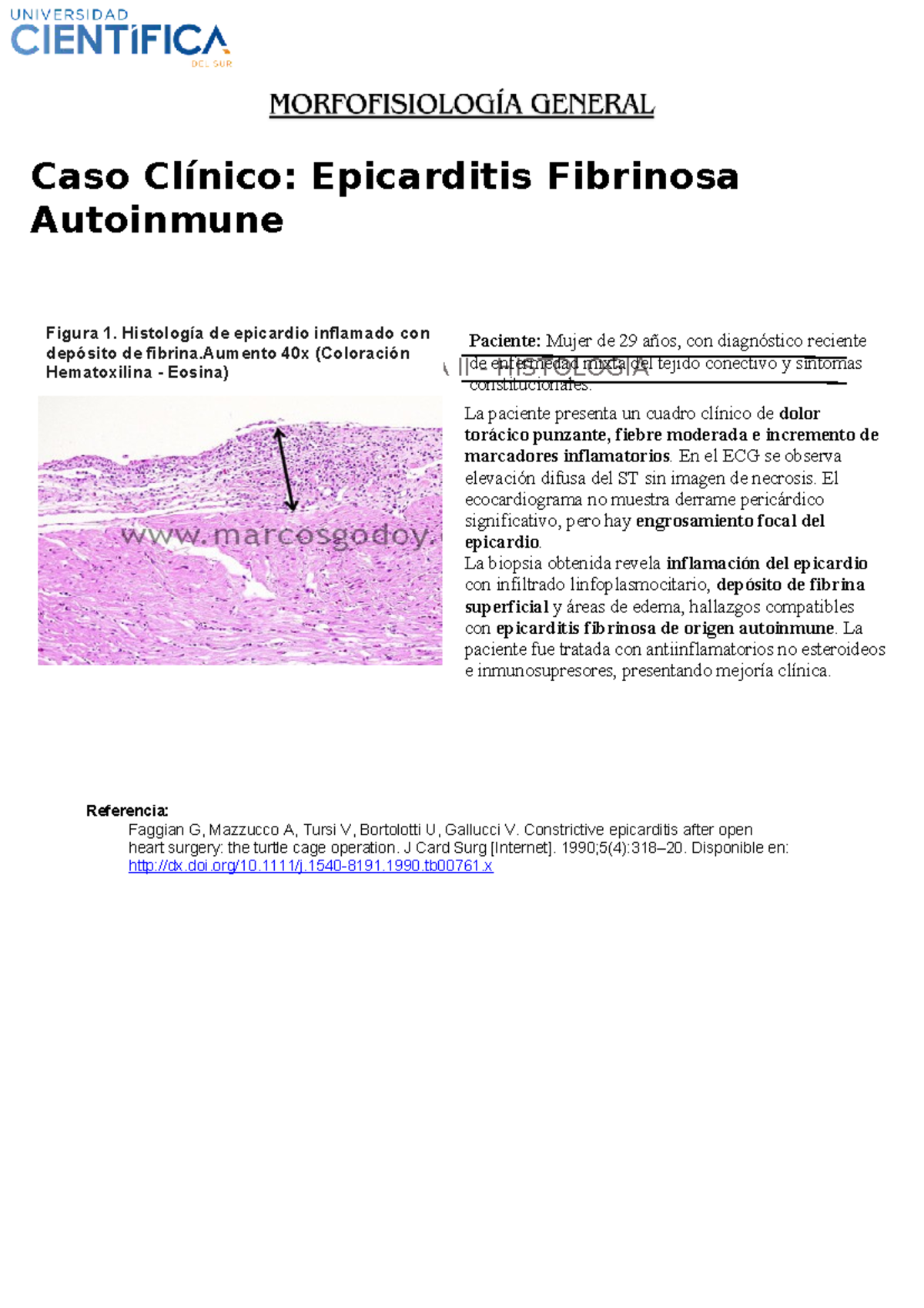 Caso Clínico: Epicarditis Fibrinosa Autoinmune - MORFOFISIOLOGIA II ...