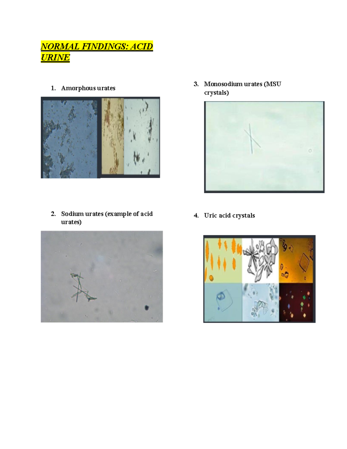 Urine-Microscopy Normal-and-Abnormal-Crystals - NORMAL FINDINGS: ACID ...