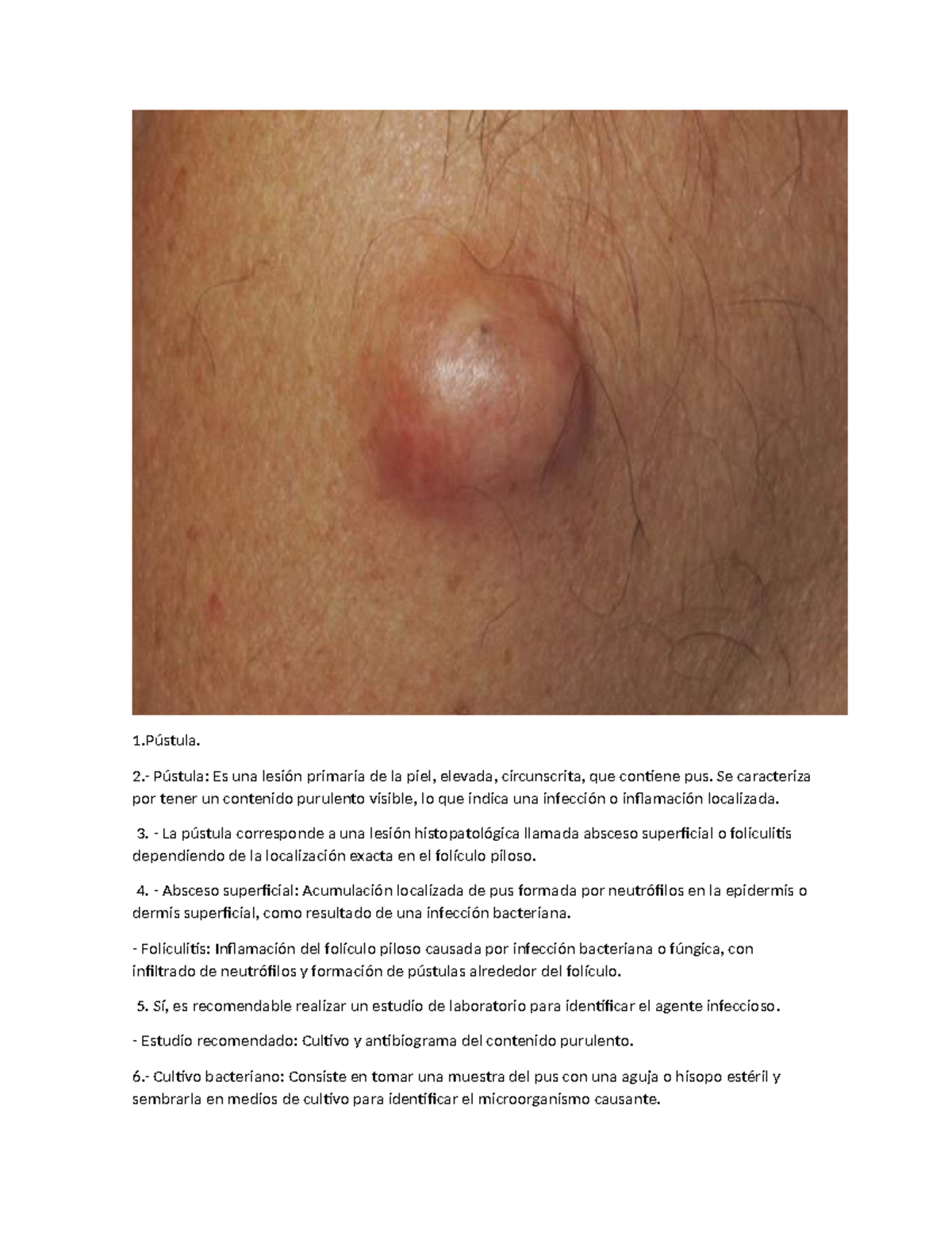 Lesiones Tegumentarias: Pústulas y Abscesos Superficiales - Studocu