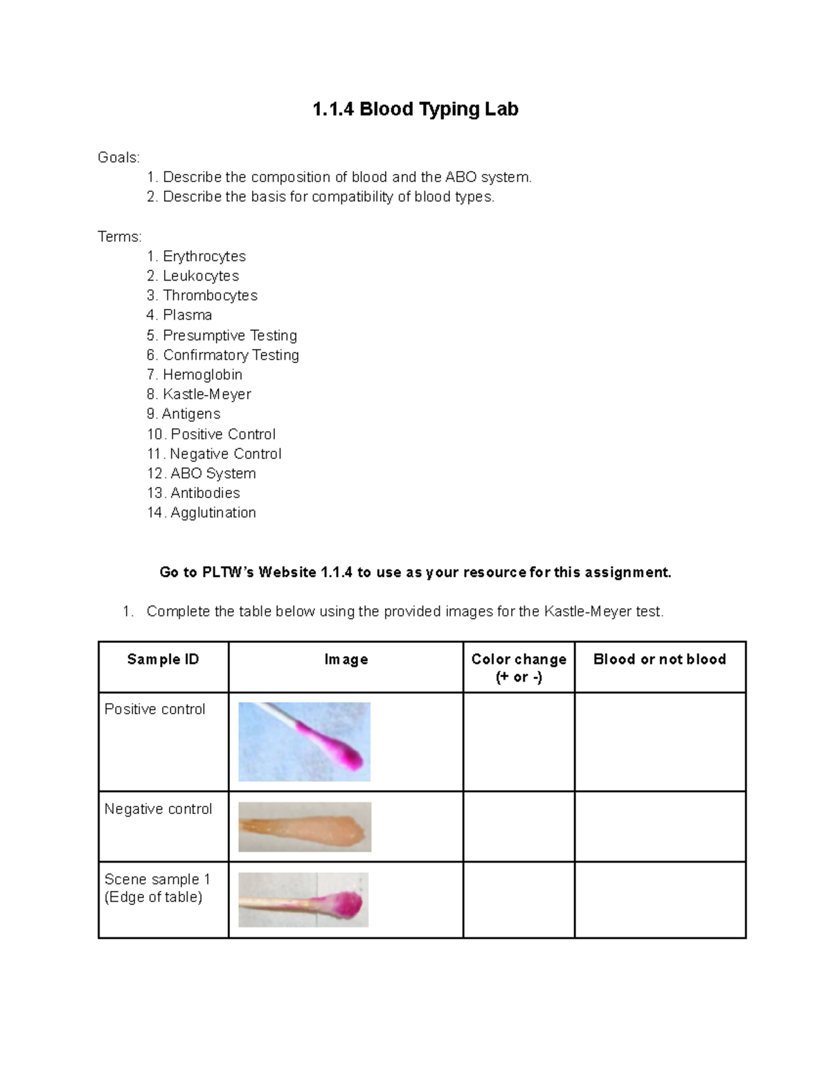 1.1.4 Blood Typing Lab - PTLW lab - 1.1 Blood Typing Lab Goals: 1 ...