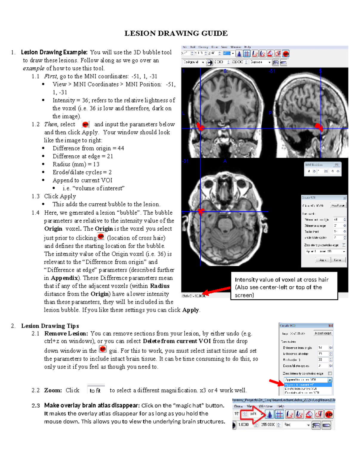 Lesion drawing guide: Using the 3D bubble tool for lesions - Studocu