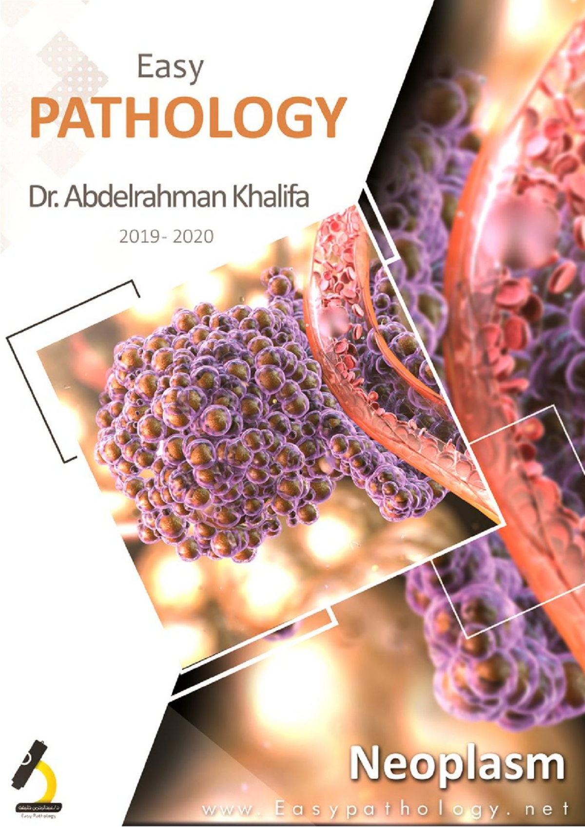 Easy Pathology [ Neoplasia ] - Pathophysiology And Parasitology - Studocu