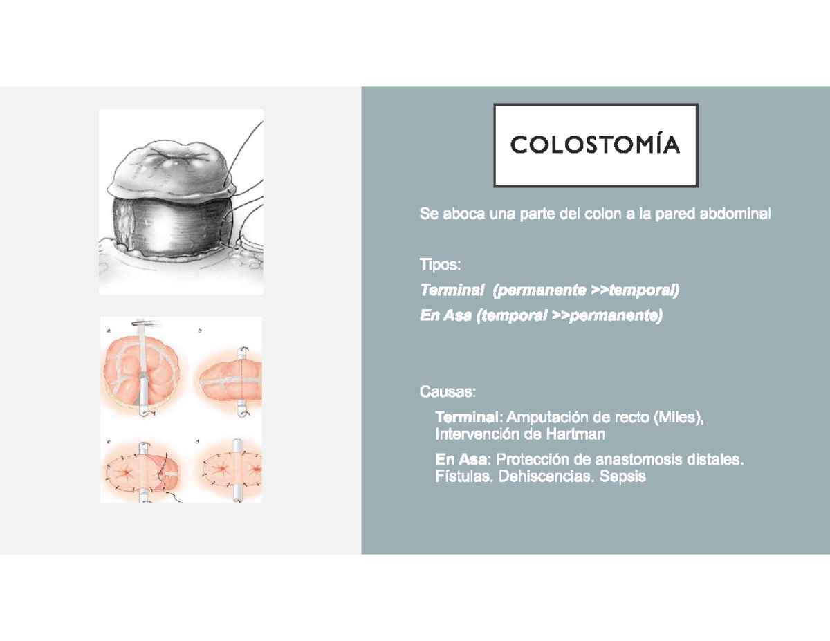Resumen de Colostomía: Tipos, Complicaciones y Cuidados - Studocu