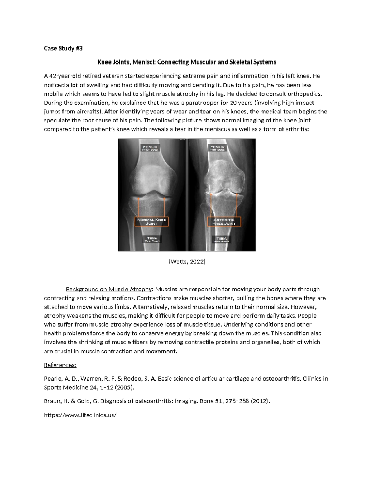 Case Study 3 - Knee Joints and Muscle Atrophy Analysis - Studocu