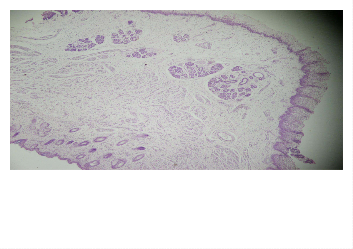Histo Lab Images: Sagittal Section of Lip and Oral Mucosa Analysis ...
