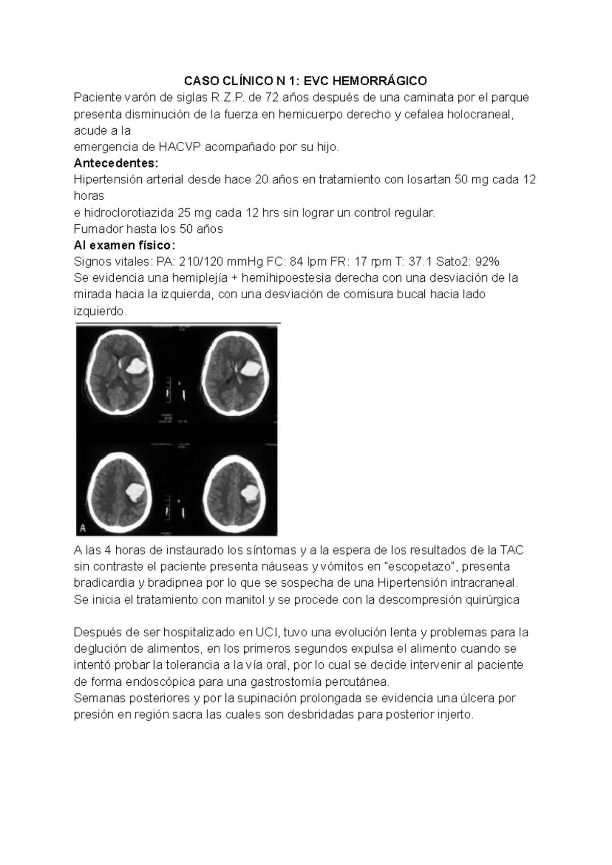 Caso Clínico 1: EVC Hemorrágico y Manejo en UCI - Studocu