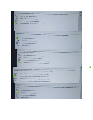 Acute sinusitis soap note - SOAP NOTE Sarah Condon CHIEF COMPLAINT (CC ...