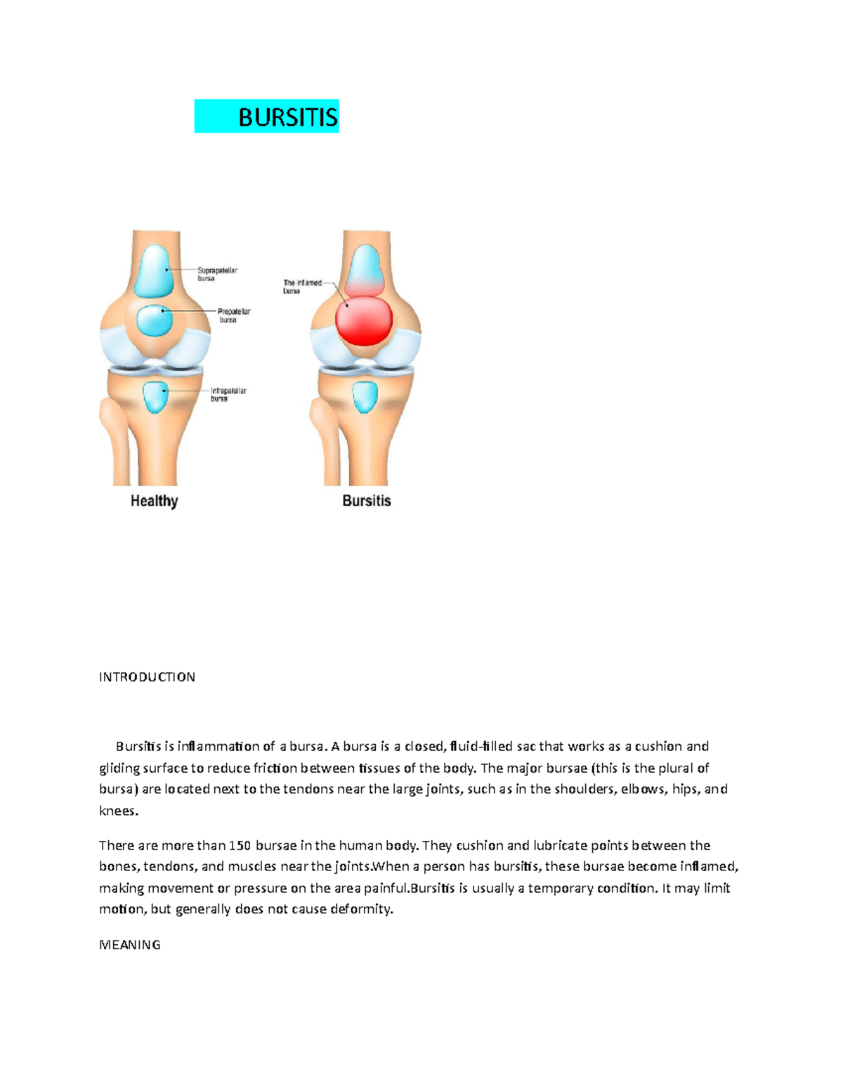 Bursitis - WPS Office Lecture Notes on Inflammation and Treatment - Studocu