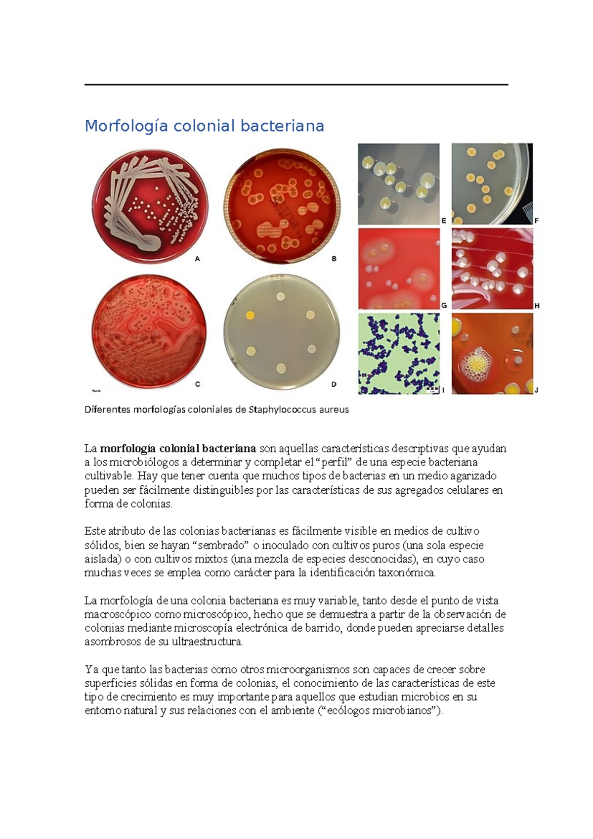 Exposicion - Espero ayude - Morfología colonial bacteriana Diferentes ...