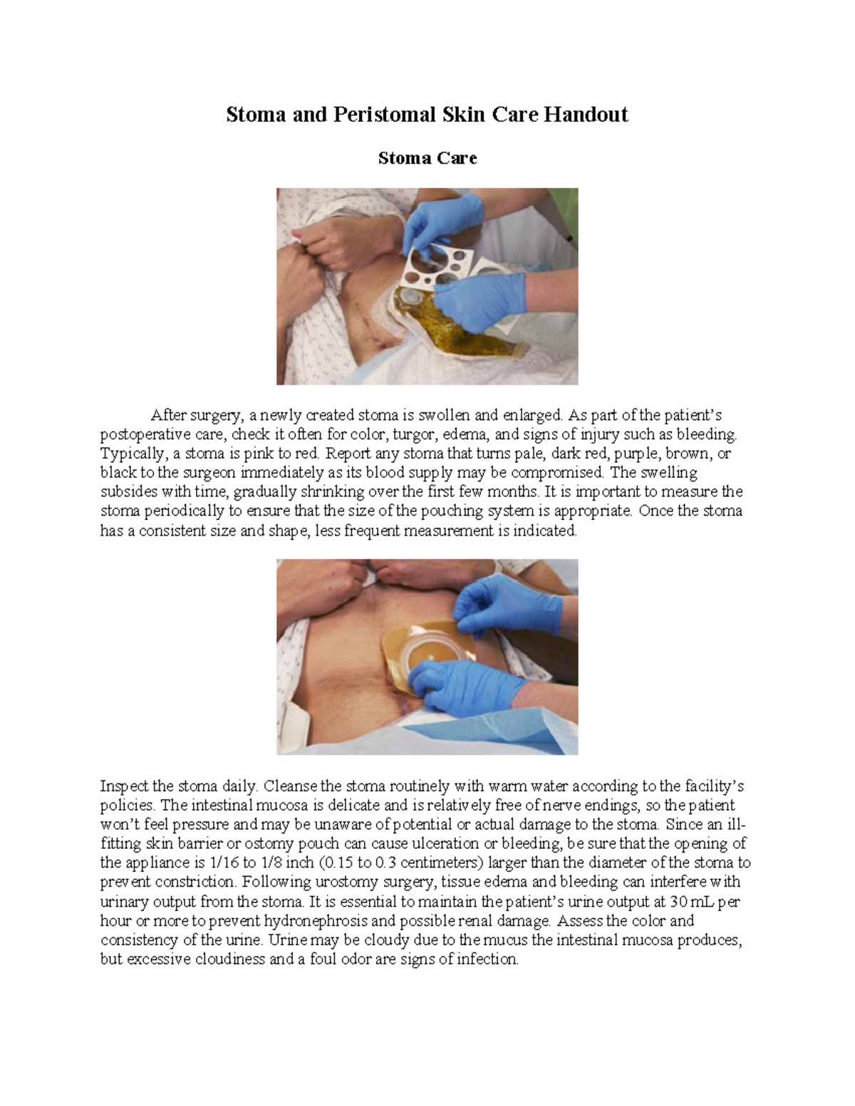 Stomaand Periostomal Skin Care Handout - Stoma and Peristomal Skin Care ...