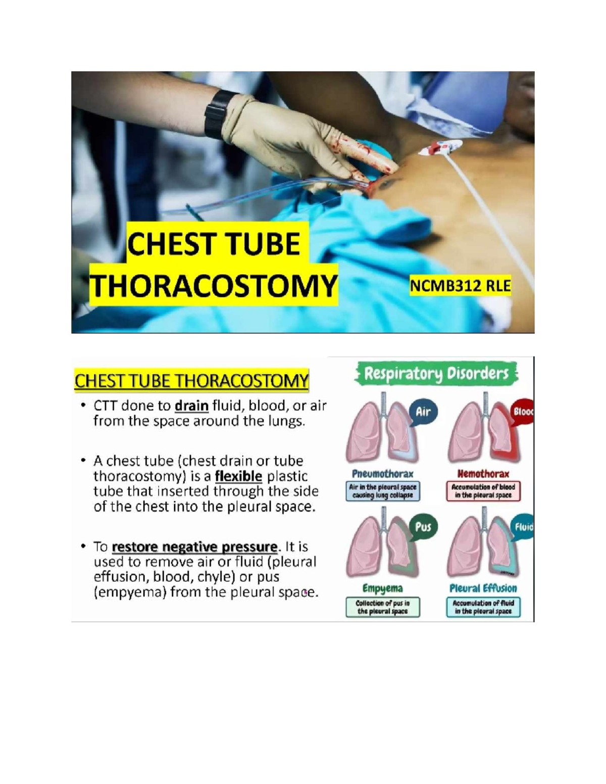 NCMB312 Chest Tube Thoracostomy: Procedures, Considerations & Care ...