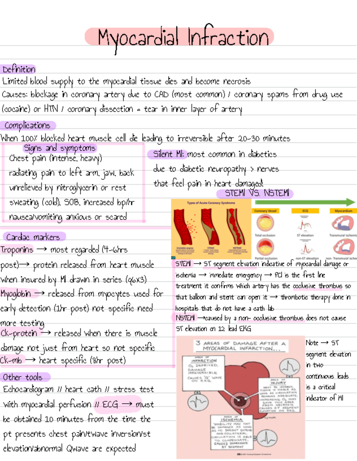 Cardiac-3 - Myocardial Infarction PART 1 made easy - Myocardial ...